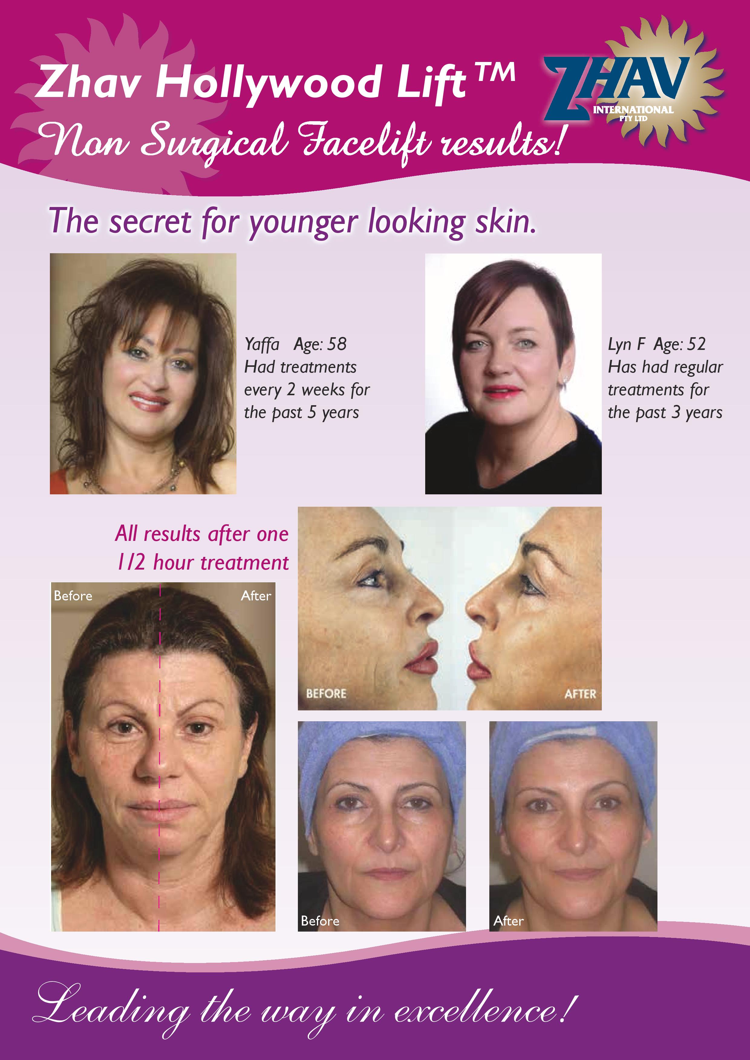 Zhav Dynamic Derma Lift | Yaffa Zhav - Skin Care Clinic